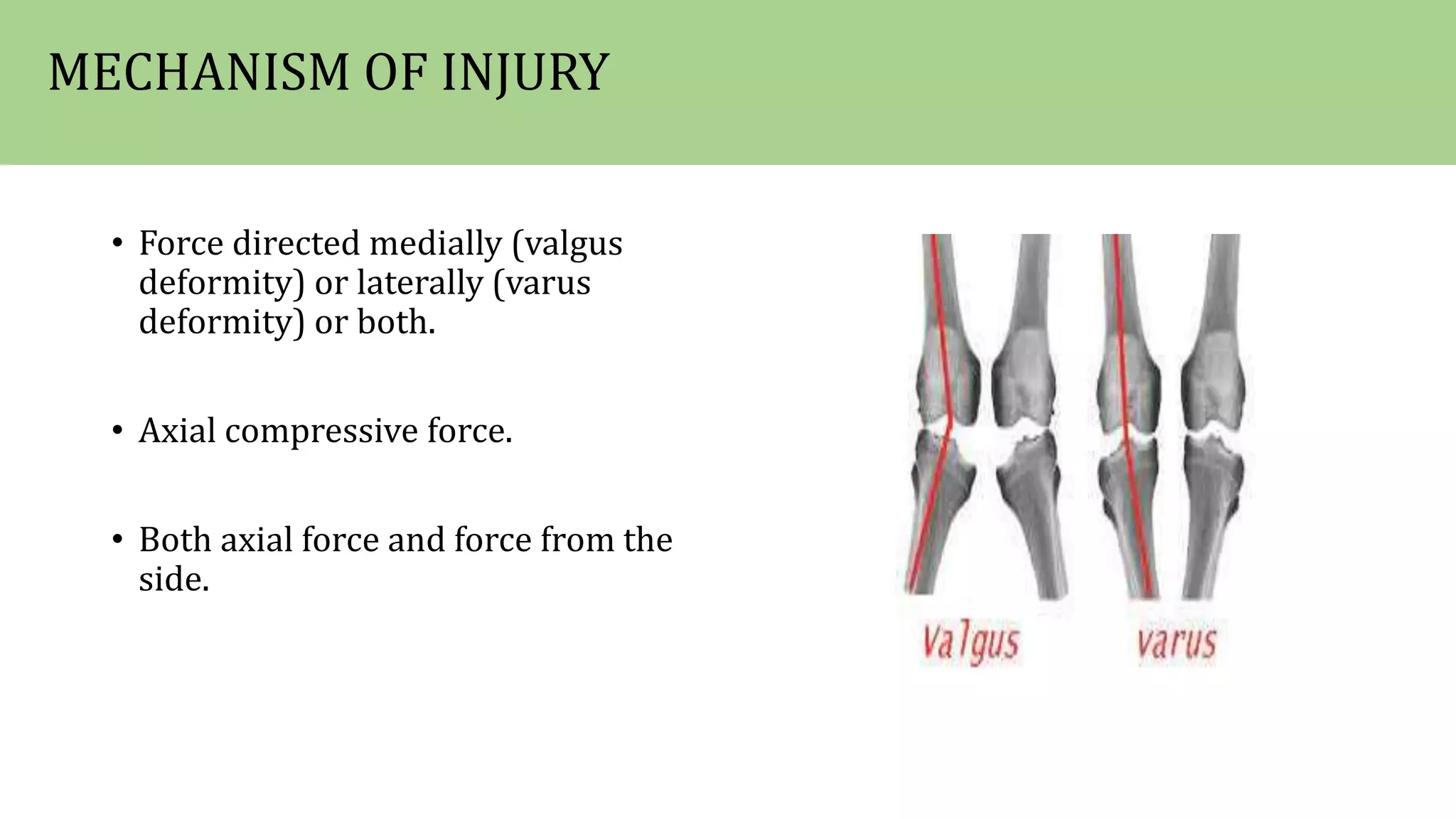 DISTAL FEMUR, PATELLA, PROXIMAL TIBIA FRACTURE.pptx