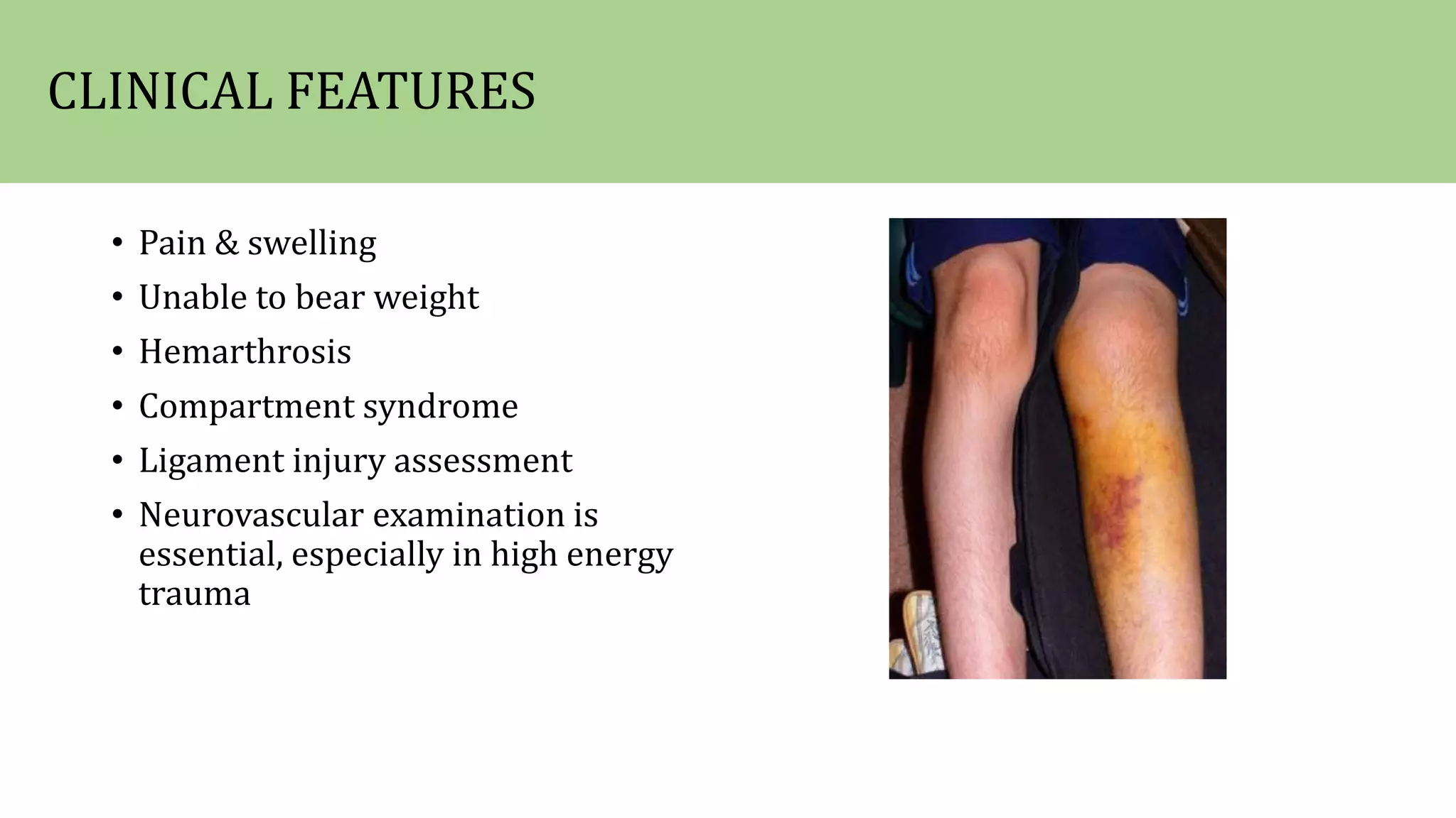 DISTAL FEMUR, PATELLA, PROXIMAL TIBIA FRACTURE.pptx