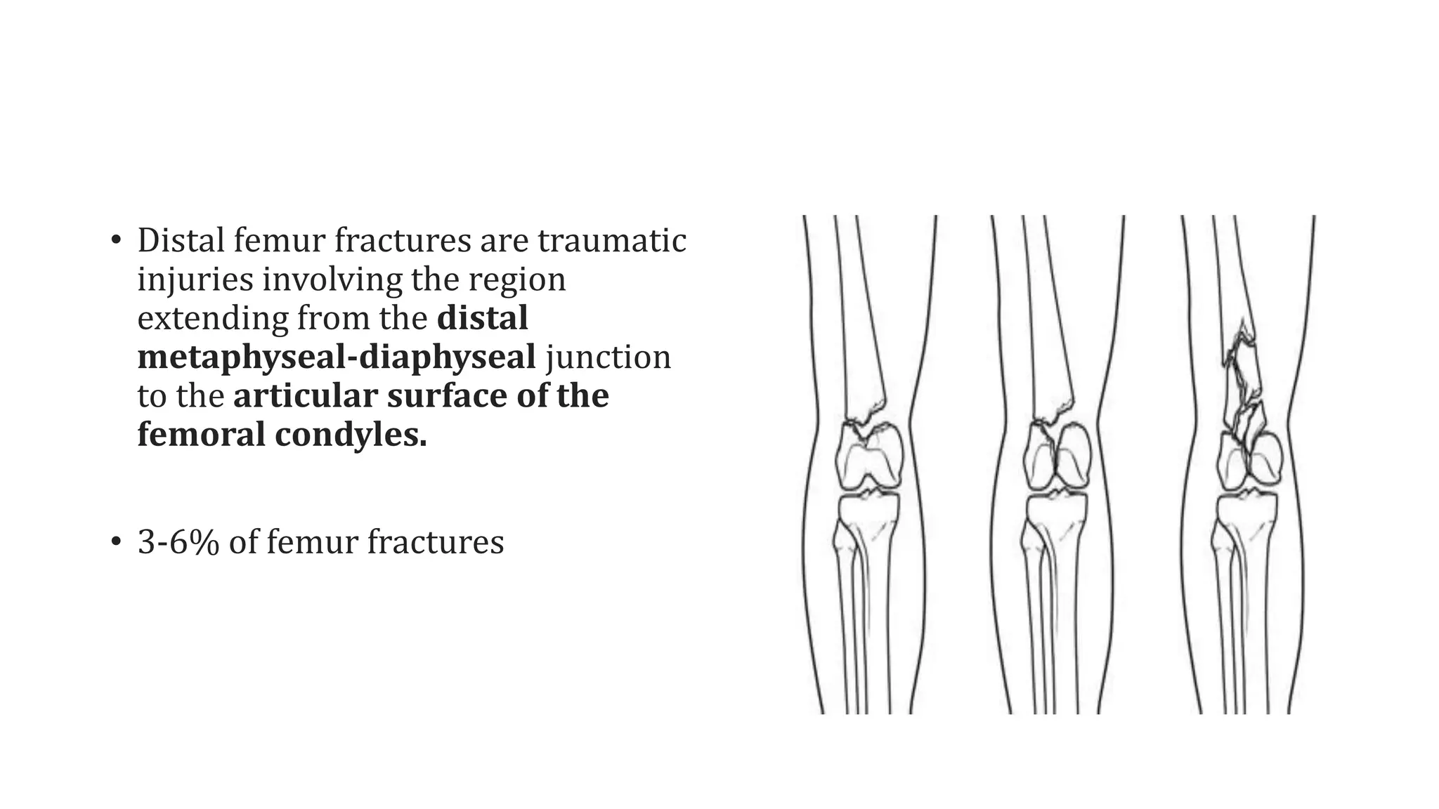 DISTAL FEMUR, PATELLA, PROXIMAL TIBIA FRACTURE.pptx