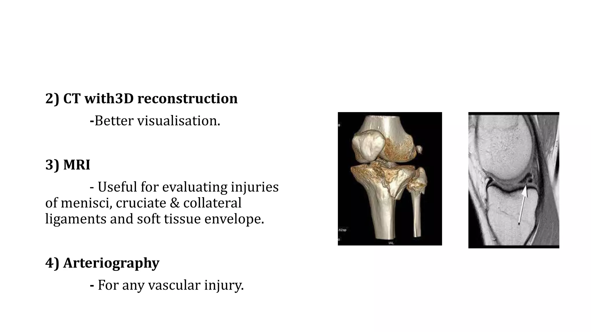 DISTAL FEMUR, PATELLA, PROXIMAL TIBIA FRACTURE.pptx