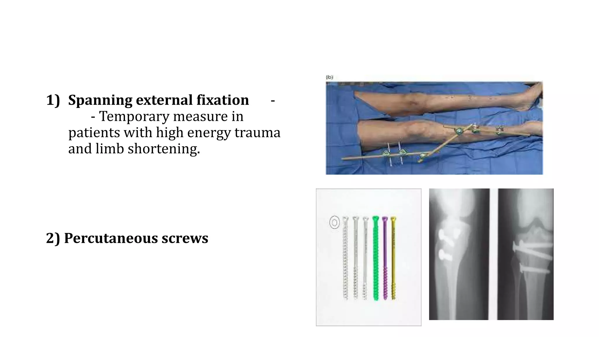 DISTAL FEMUR, PATELLA, PROXIMAL TIBIA FRACTURE.pptx