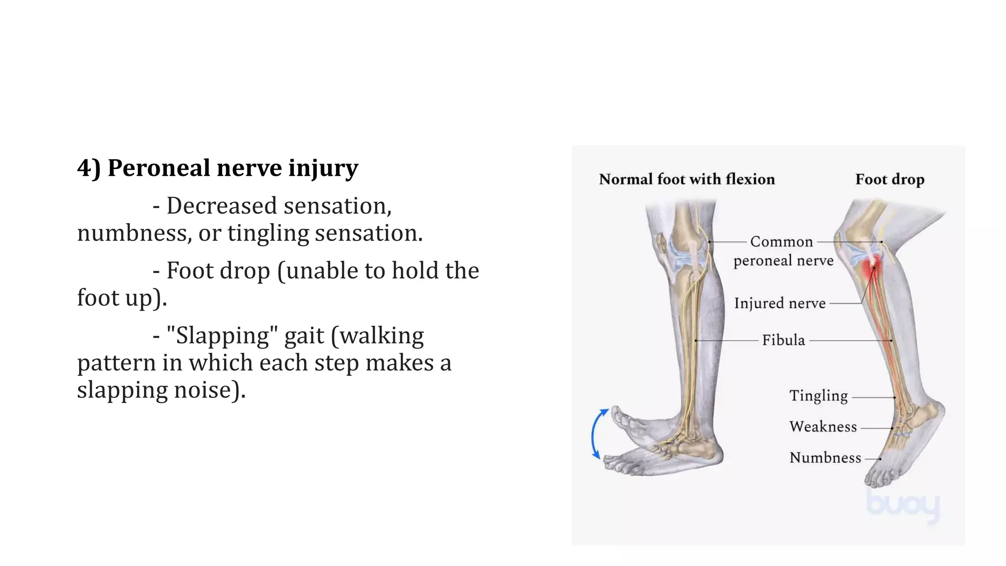DISTAL FEMUR, PATELLA, PROXIMAL TIBIA FRACTURE.pptx