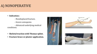 DISTAL FEMUR, PATELLA, PROXIMAL TIBIA FRACTURE.pptx