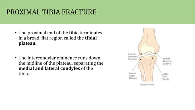 DISTAL FEMUR, PATELLA, PROXIMAL TIBIA FRACTURE.pptx