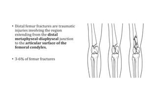 DISTAL FEMUR, PATELLA, PROXIMAL TIBIA FRACTURE.pptx