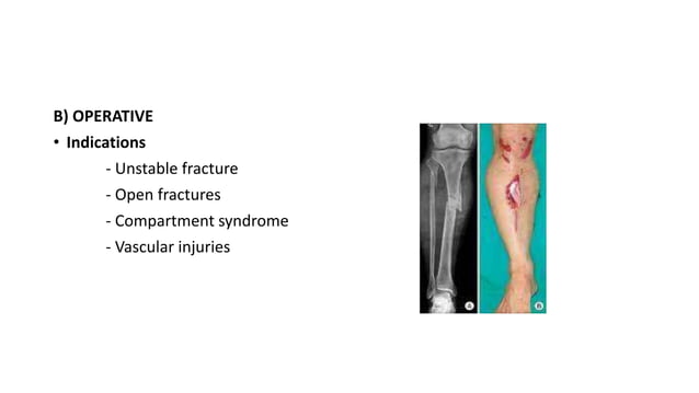 DISTAL FEMUR, PATELLA, PROXIMAL TIBIA FRACTURE.pptx