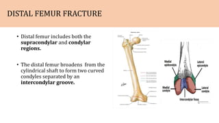 Distal Femoral Region