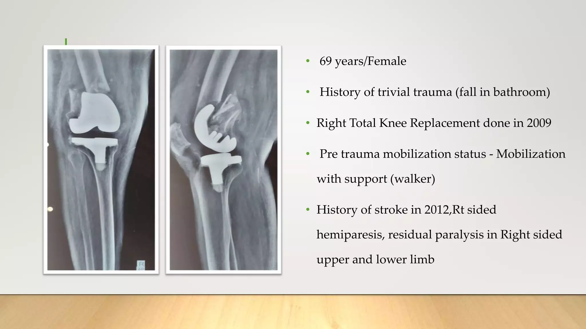 Distal Femur Periprosthetic Fracture.pptx