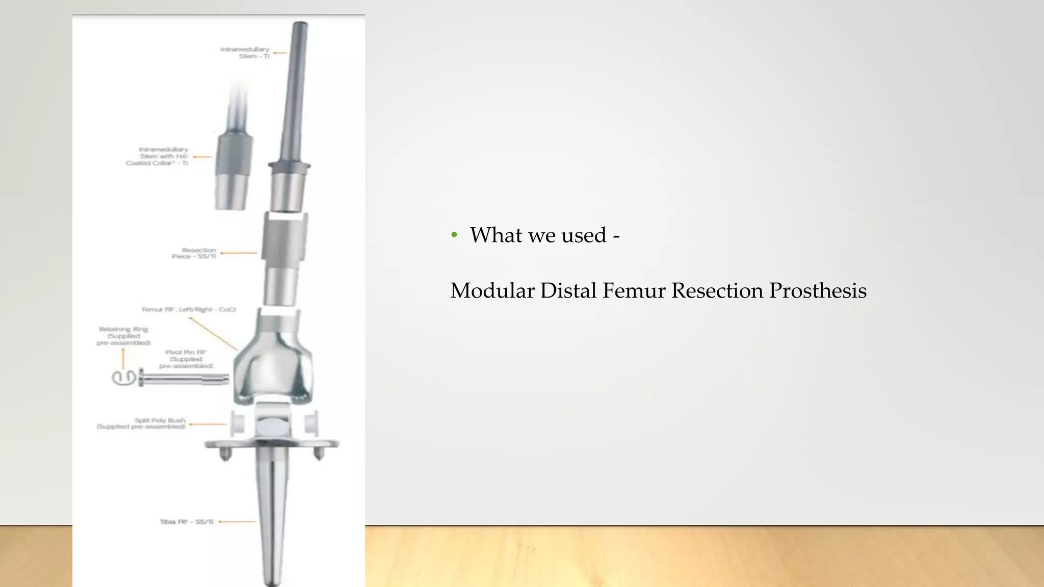 Distal Femur Periprosthetic Fracture.pptx