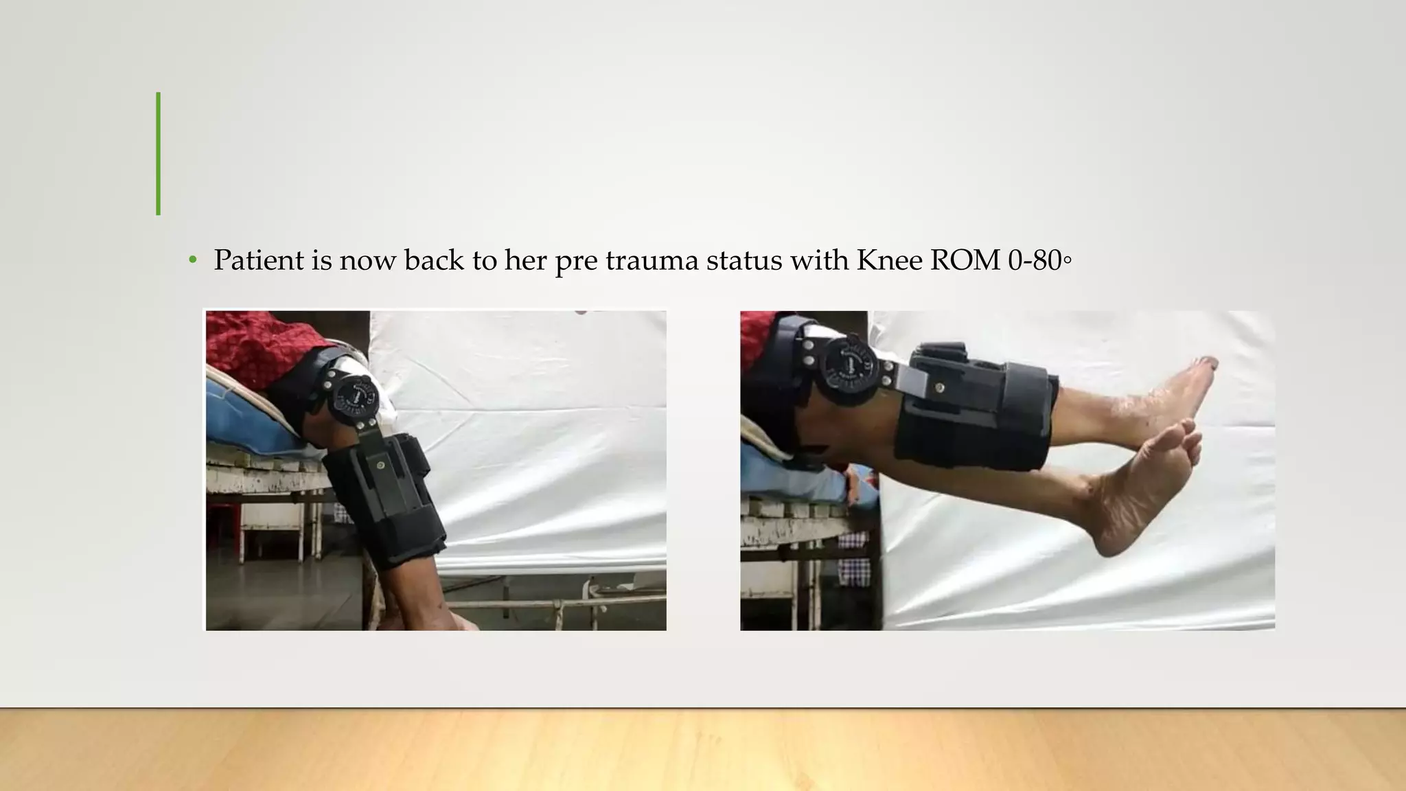 Distal Femur Periprosthetic Fracture.pptx