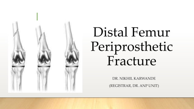 Distal Femur Periprosthetic Fracture.pptx