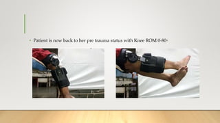 Distal Femur Periprosthetic Fracture.pptx