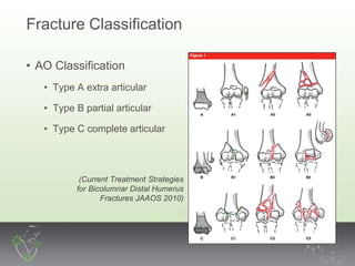 Distal Humeral Fractures – How to Fix Them, with Correlation with ...