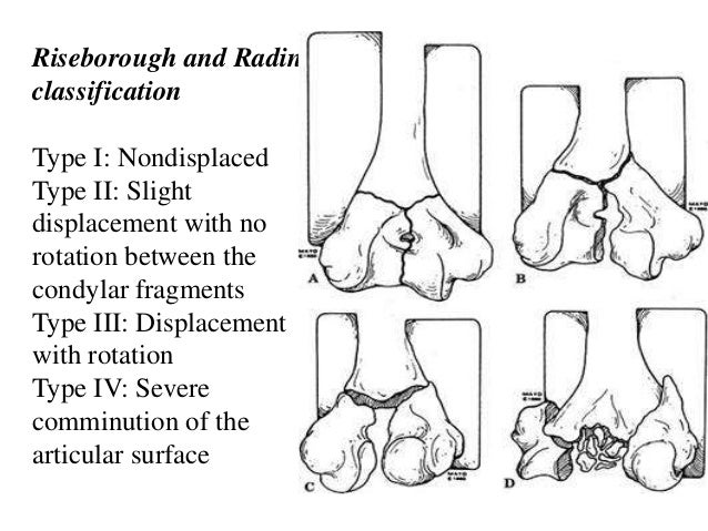 Distal humerus.