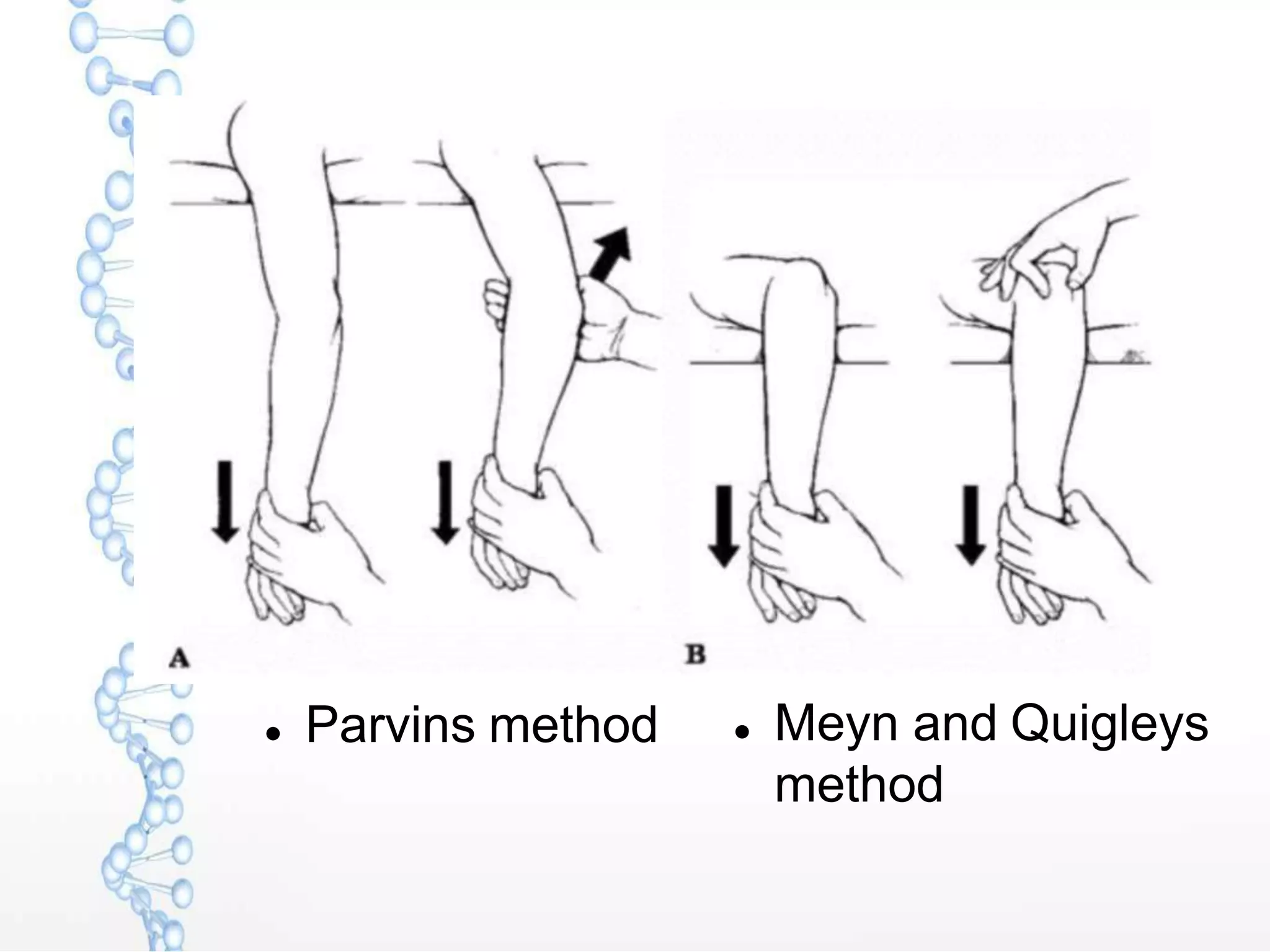 Distal humerus fracture and elbow dislocation by dr ashutosh | PPT