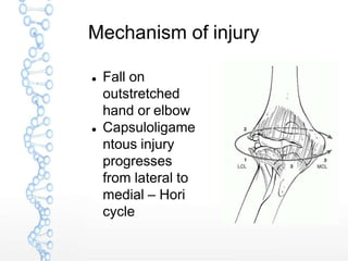 Distal humerus fracture and elbow dislocation by dr ashutosh | PPTX