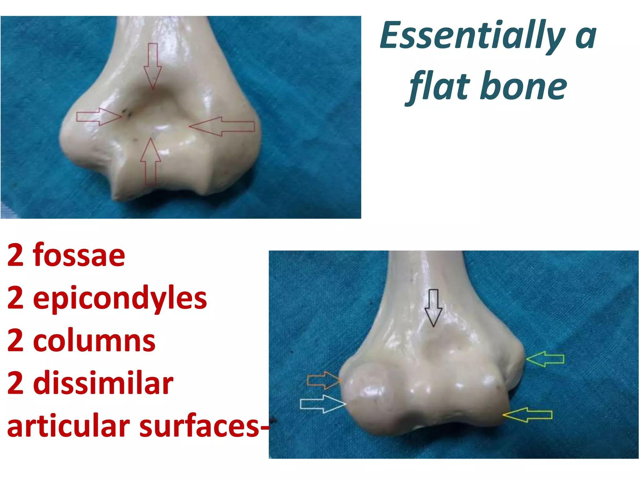 Distal humerus fracture fixation dr mohamed ashraf-HOD-govt TD medical ...