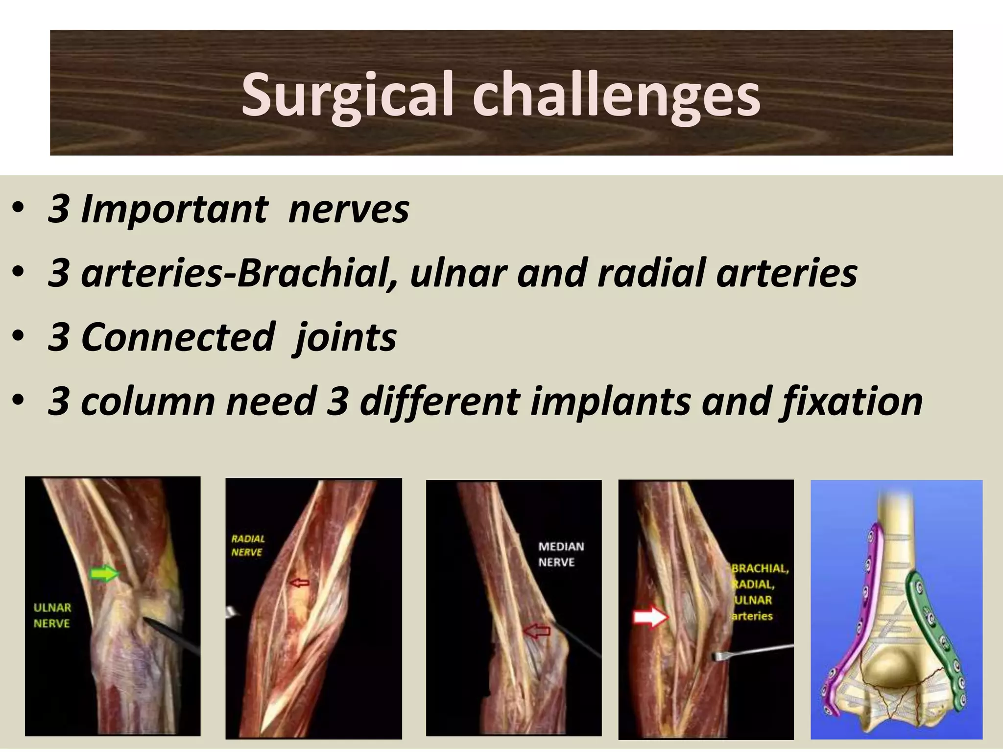 Distal humerus fracture fixation dr mohamed ashraf-HOD-govt TD medical ...