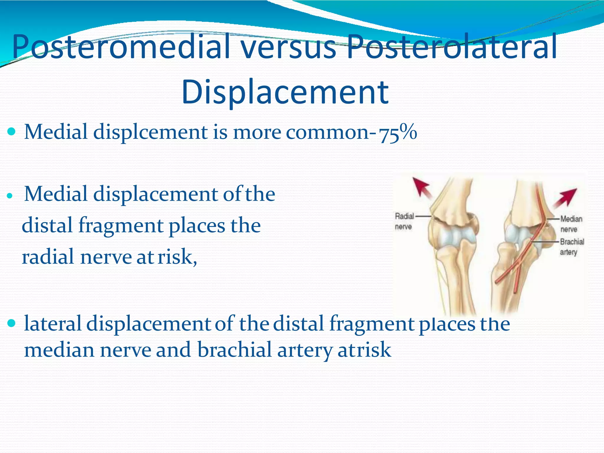 Distal humerus fracture in pediatrics by dr ashutosh | PPT