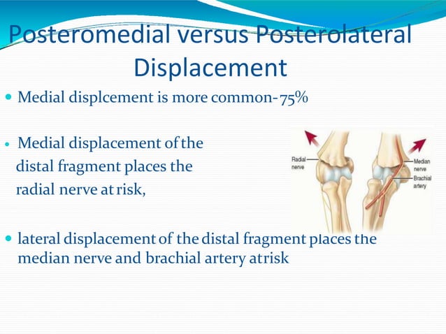 Distal humerus fracture in pediatrics by dr ashutosh | PPT
