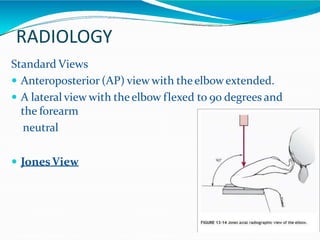 Distal humerus fracture in pediatrics by dr ashutosh | PPTX