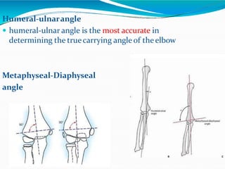 Distal humerus fracture in pediatrics by dr ashutosh | PPTX