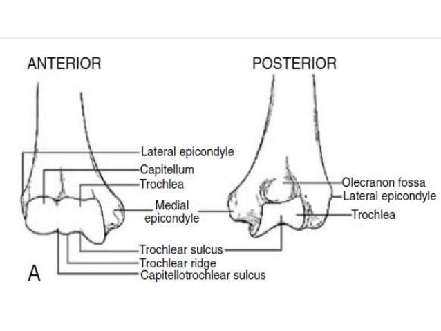 Distal humerus fractures