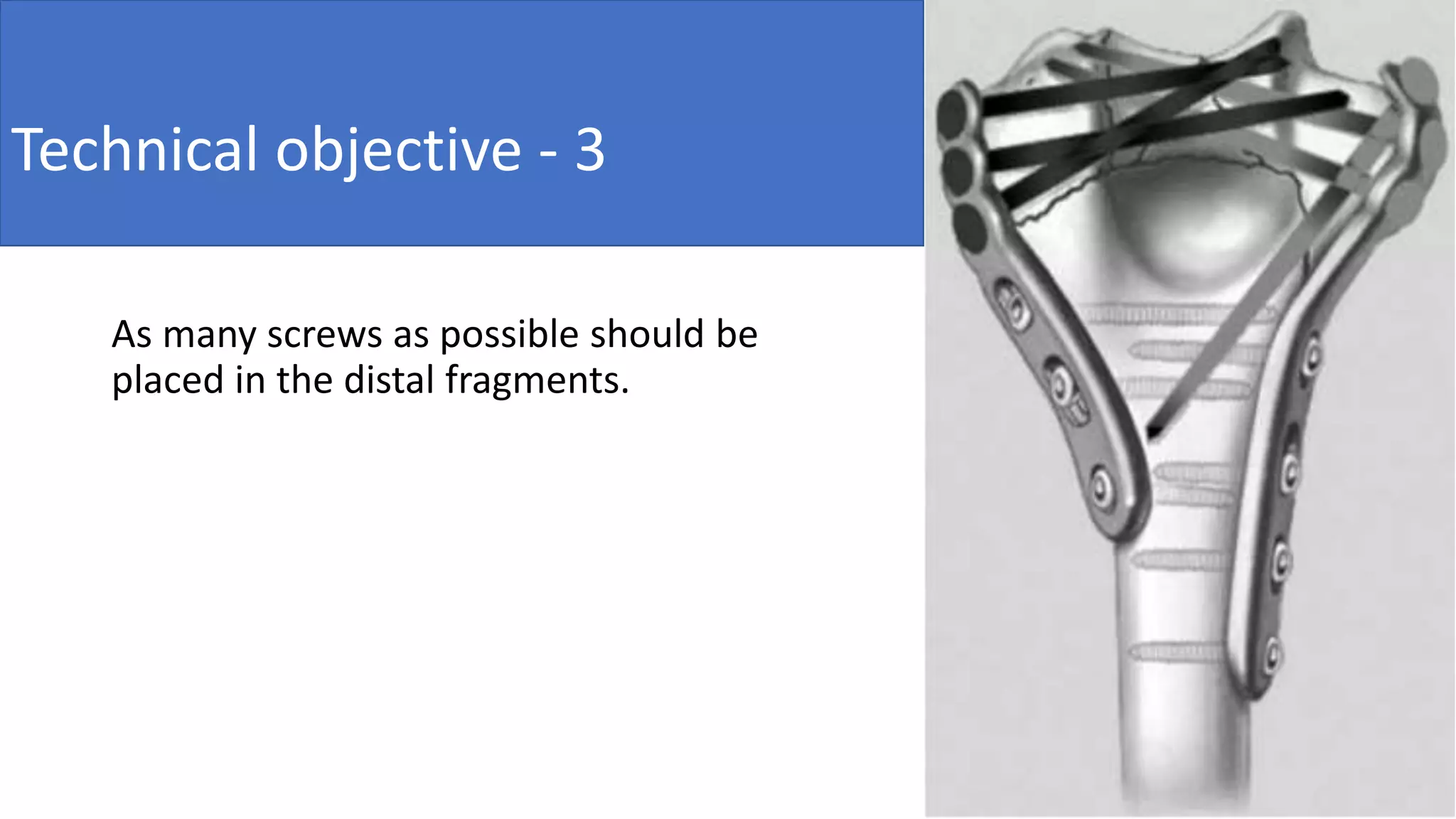 Distal Humerus Fractures.pptx