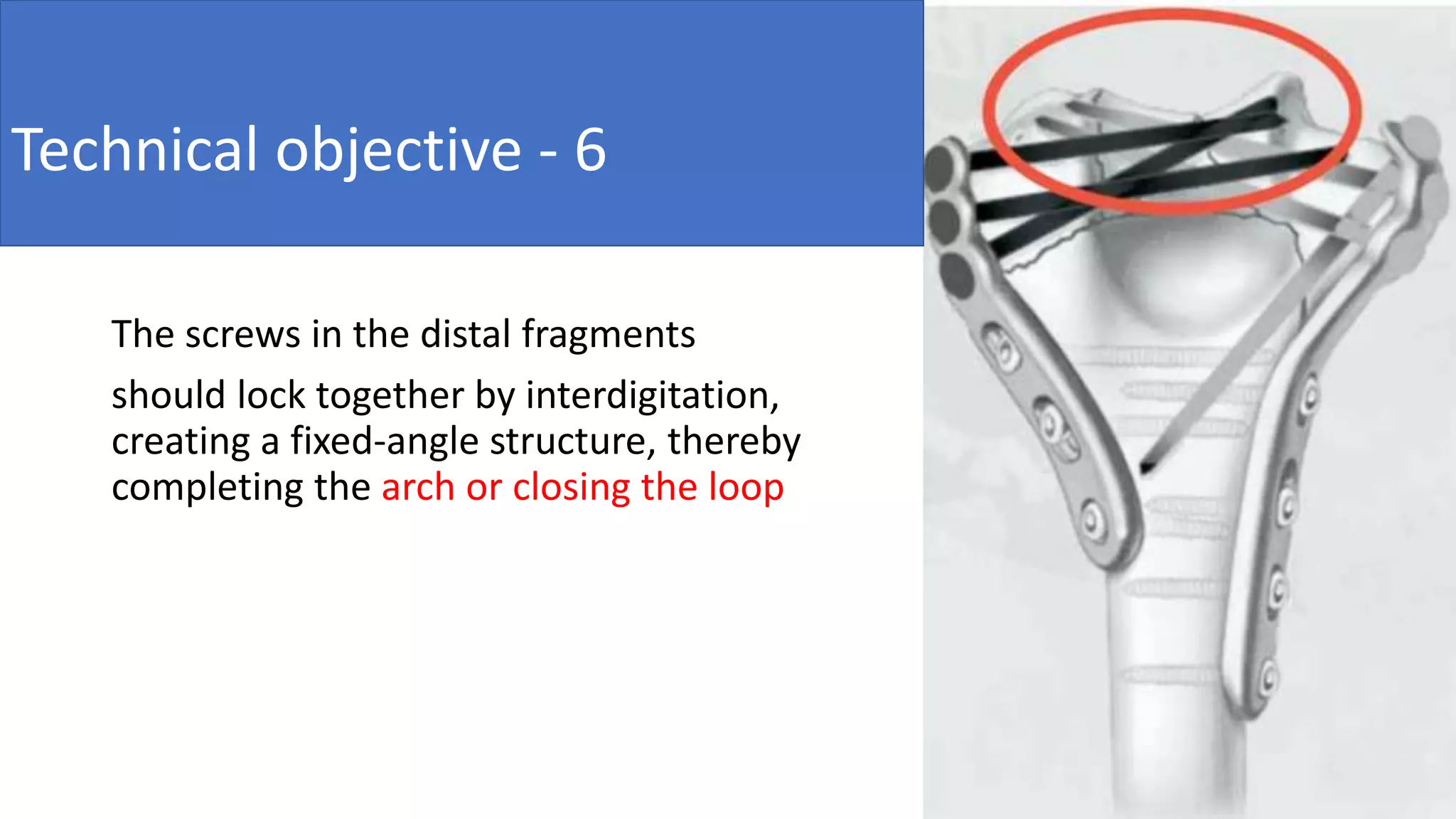 Distal Humerus Fractures.pptx