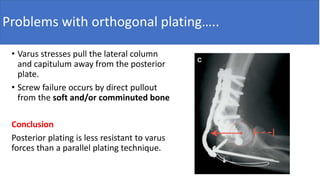 Distal Humerus Fractures.pptx
