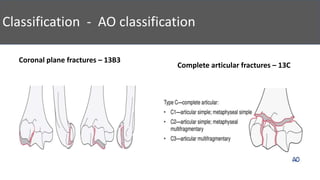 Distal Humerus Fractures.pptx