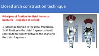 Distal Humerus Fractures.pptx