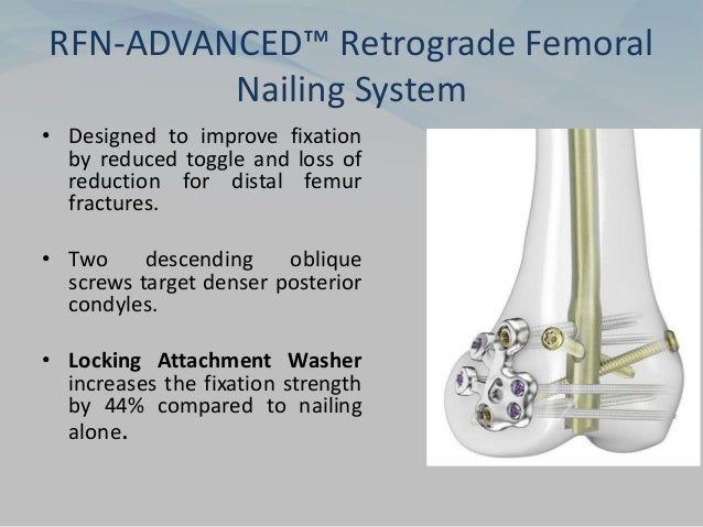 Distal Humerus Fractures.pptx