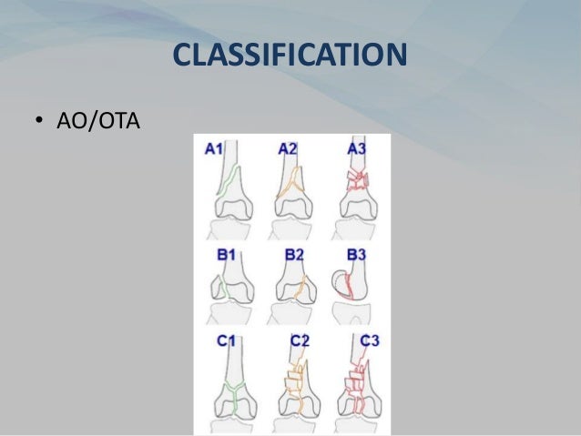 Distal Humerus Fractures.pptx
