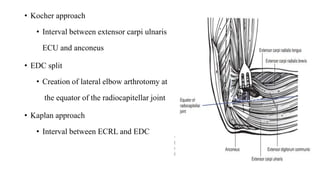 Distal humeruss.pptx