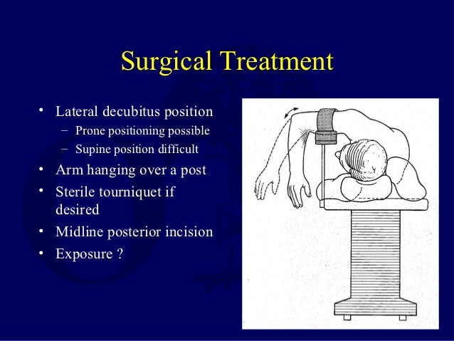 Distal humerus revised
