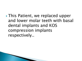 Basal implants in disatal maxilla and mandible | PPT