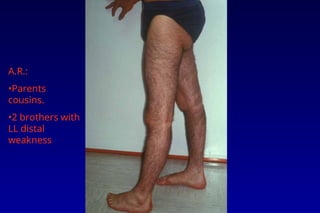 distal myopathies.ppt sms mc jaipur Rajasthan | PPT