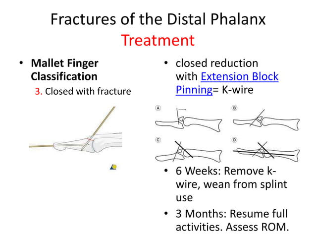 Distal phalanx fracture | PPTX