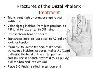 Distal phalanx fracture | PPTX