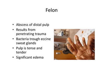 Distal phalanx fracture | PPTX