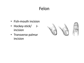Distal phalanx fracture | PPTX