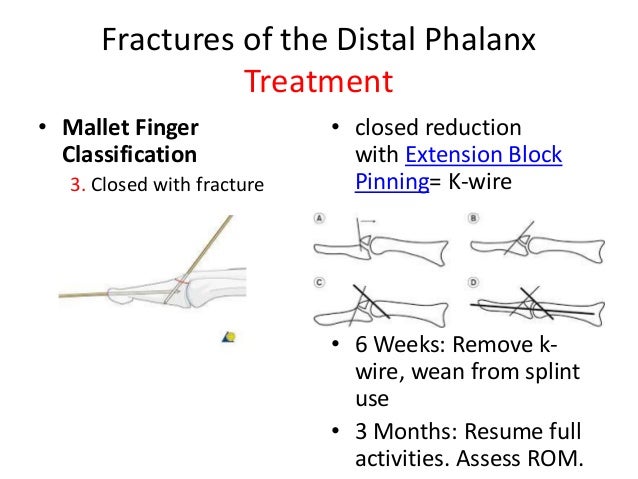 Distal phalanx fracture