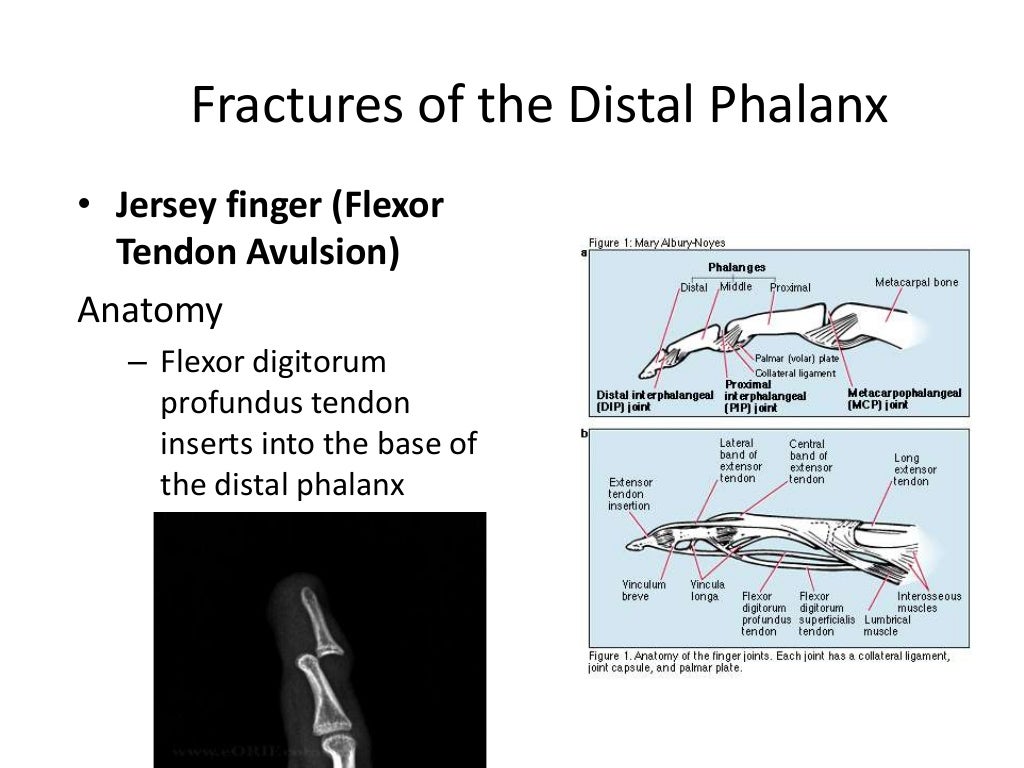Distal Phalanx