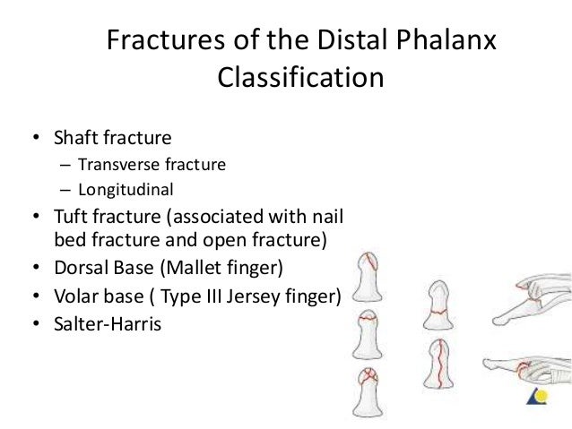 Distal phalanx fracture