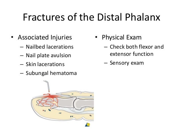 Distal phalanx fracture