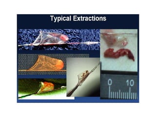 Distal protection device | PPTX