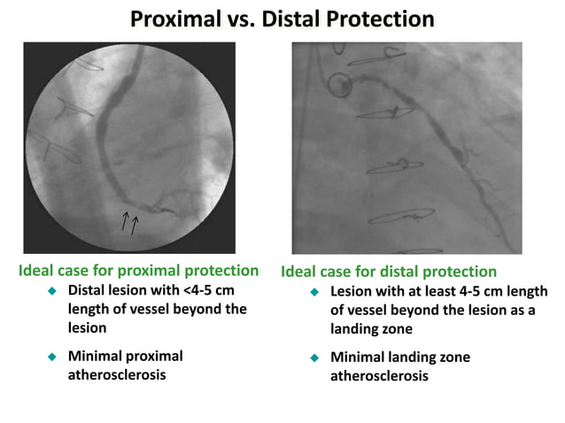 Distal protection device | PPTX | First Aid | Injuries