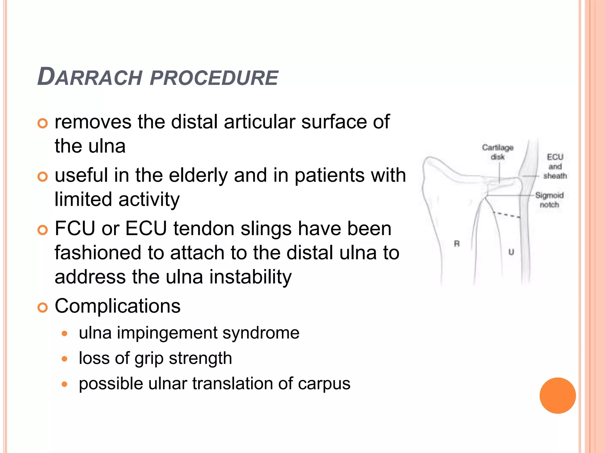 Distal radioulnar joint injuries | PPTX