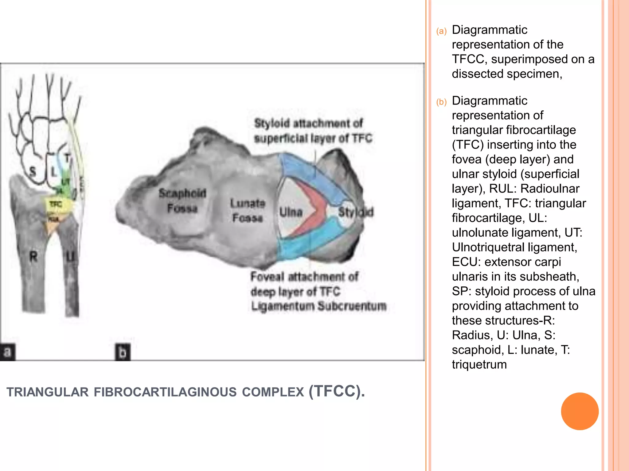 Distal radioulnar joint injuries | PPTX